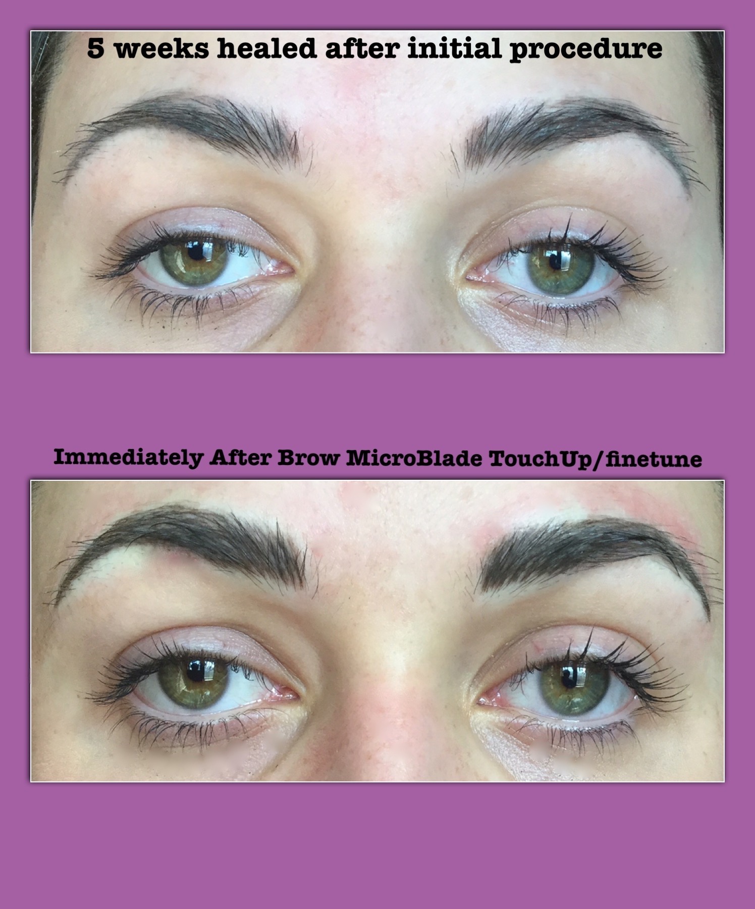 Micro-Blading Magic – Enduring Esthetics
