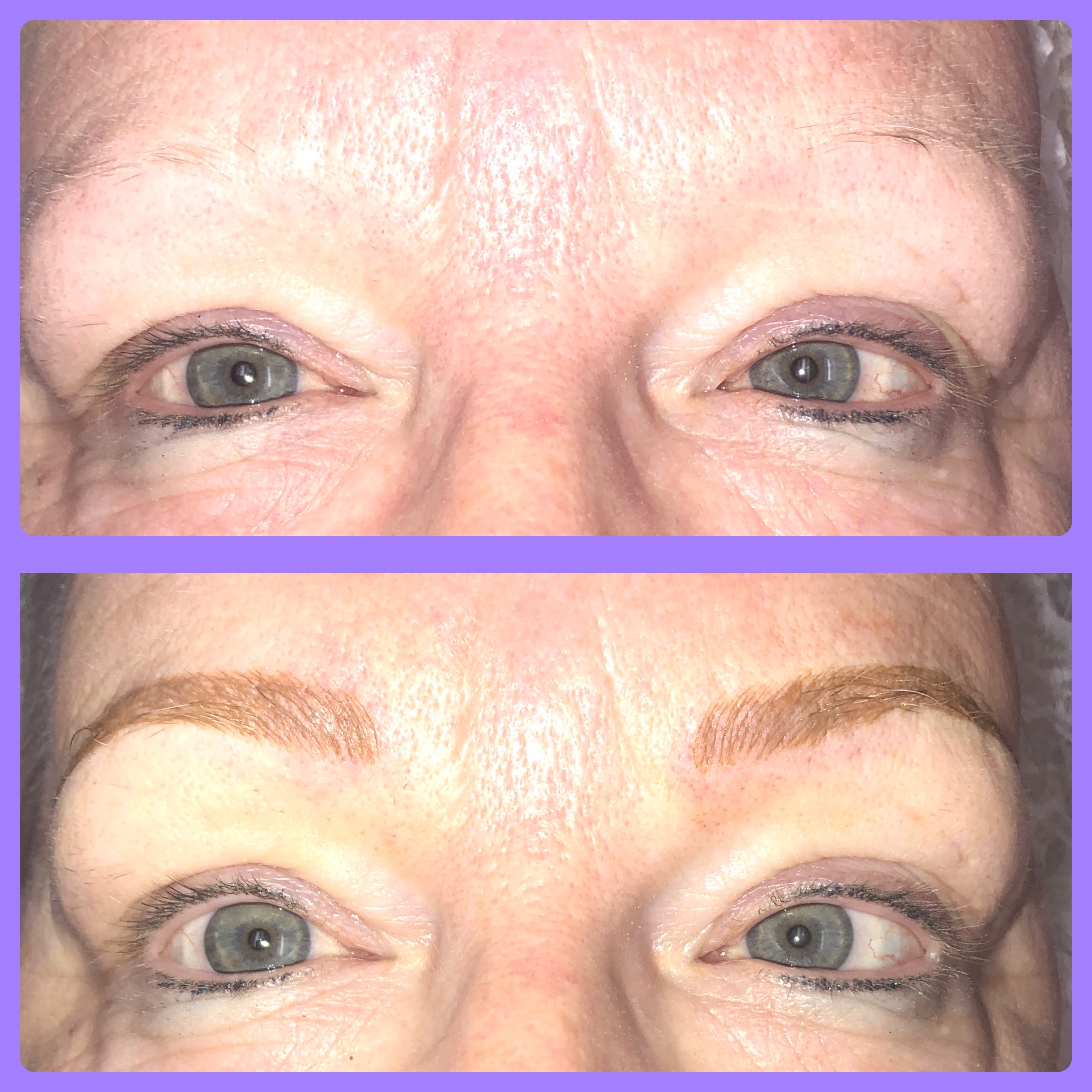 No Eyebrows to Brow WoW – Enduring Esthetics