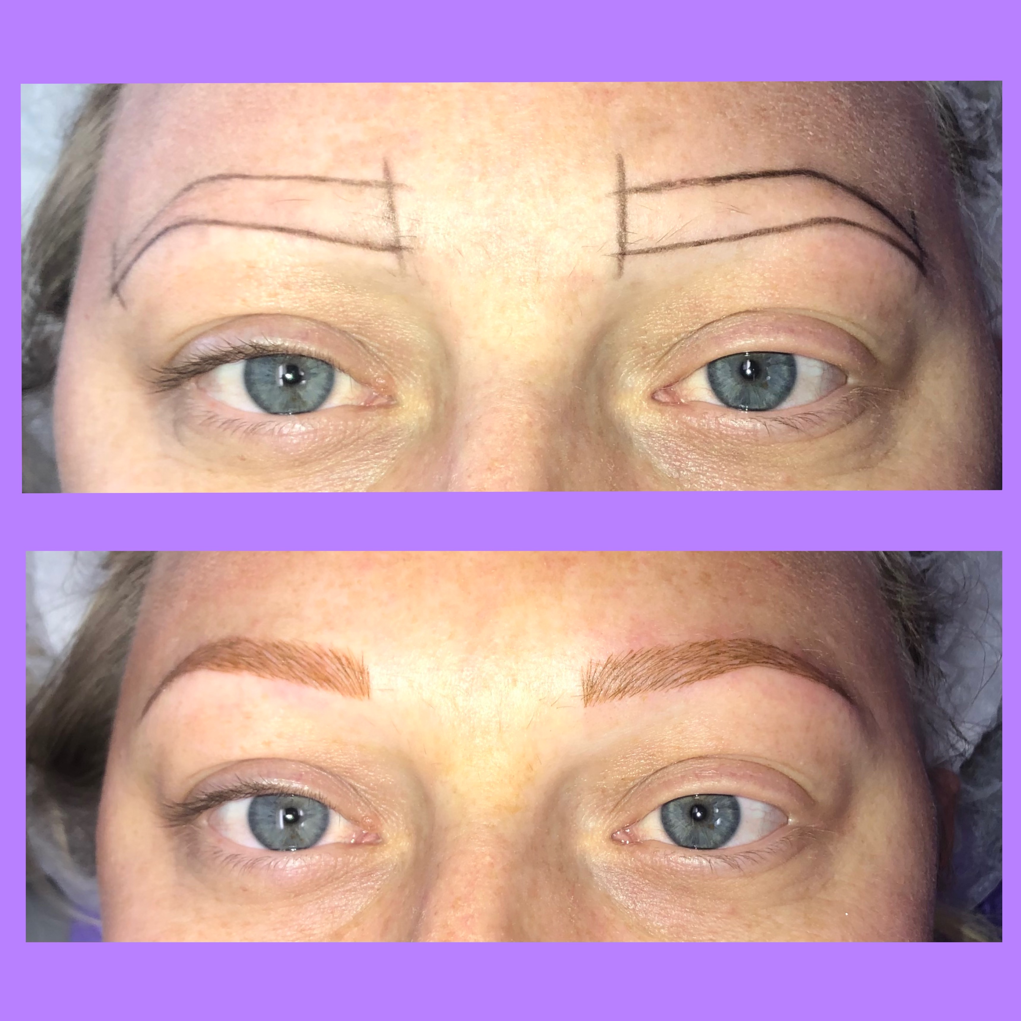 Micro-bladed Brows for Alopecia Brow Loss – Enduring Esthetics