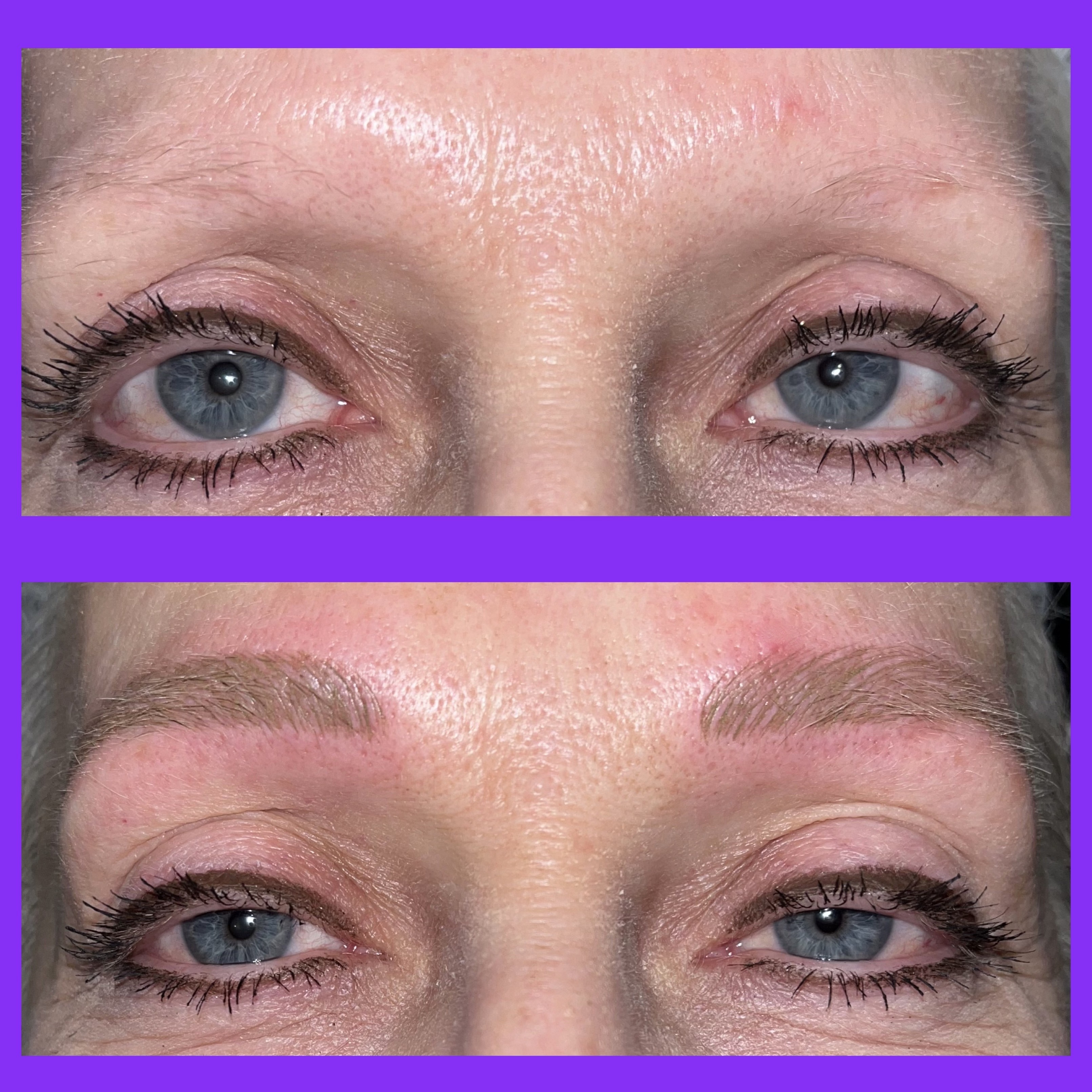 Permanent (Semi)Eyebrows : – Enduring Esthetics