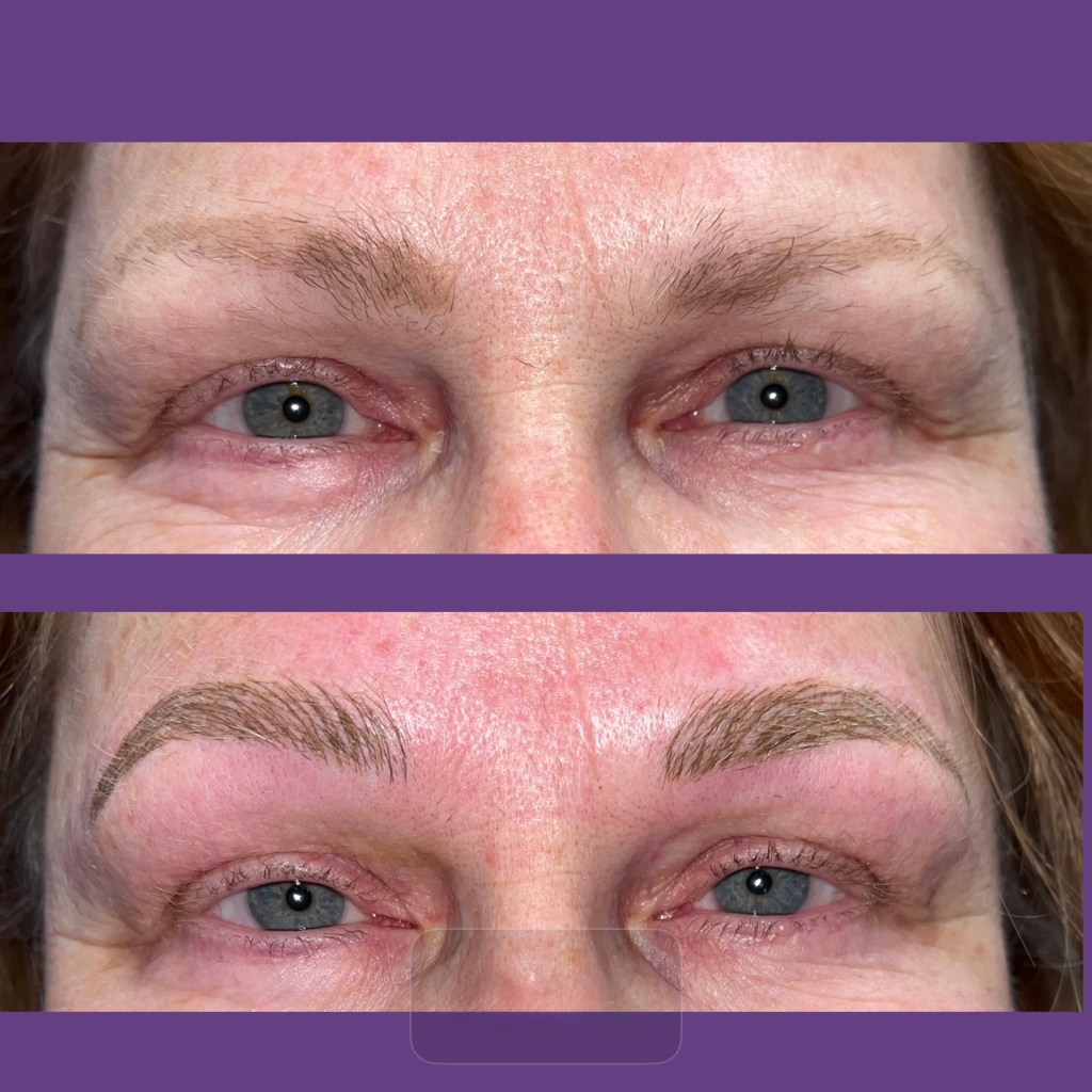 Permanent Eyebrow Micro-blading – Enduring Esthetics